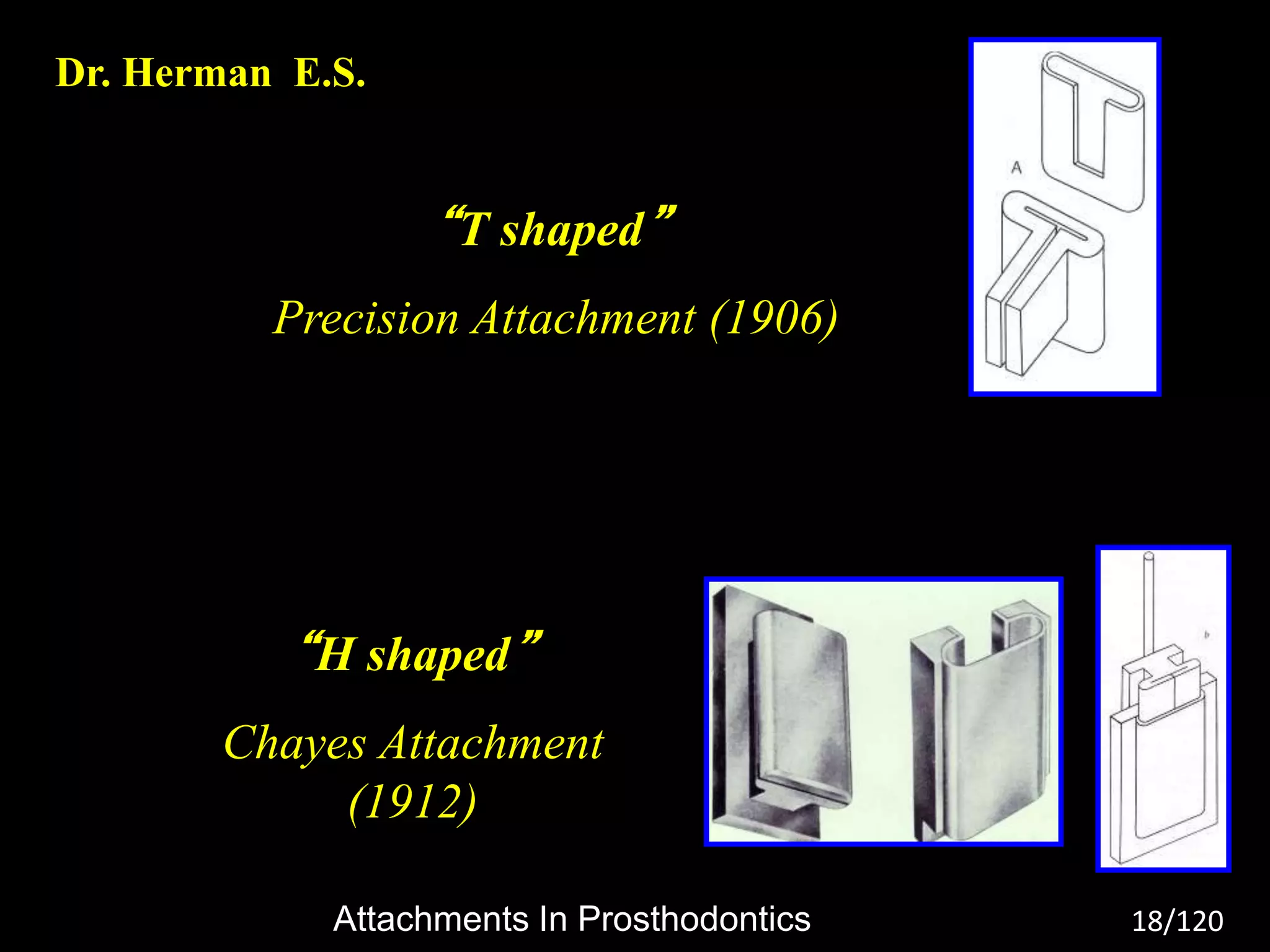 Attachments In Prosthodontics | PPTX