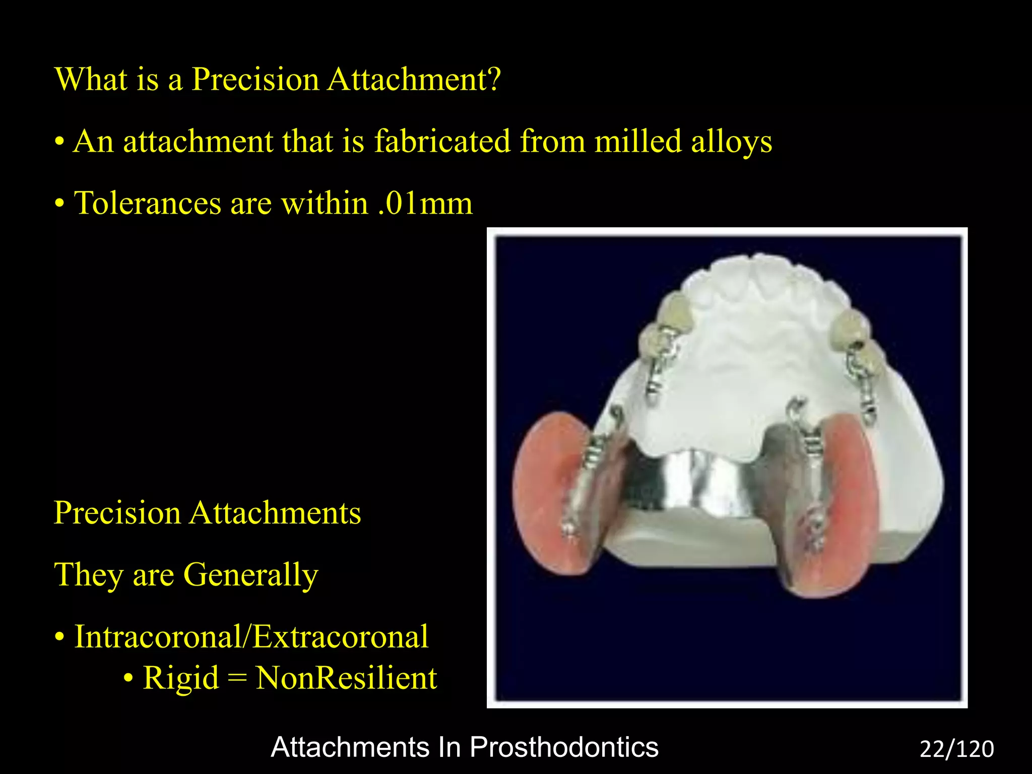 Attachments In Prosthodontics | PPTX