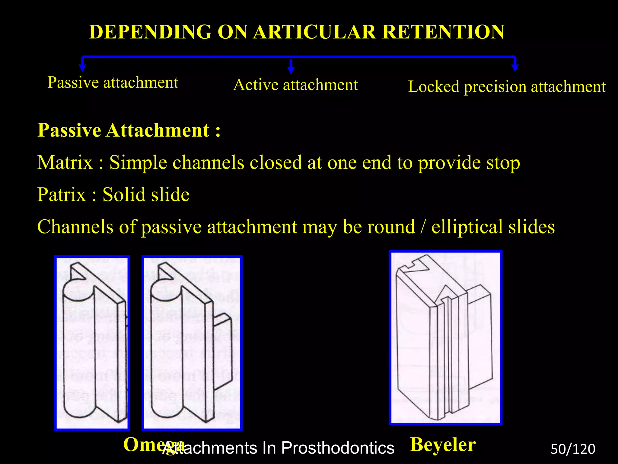 Attachments In Prosthodontics | PPTX