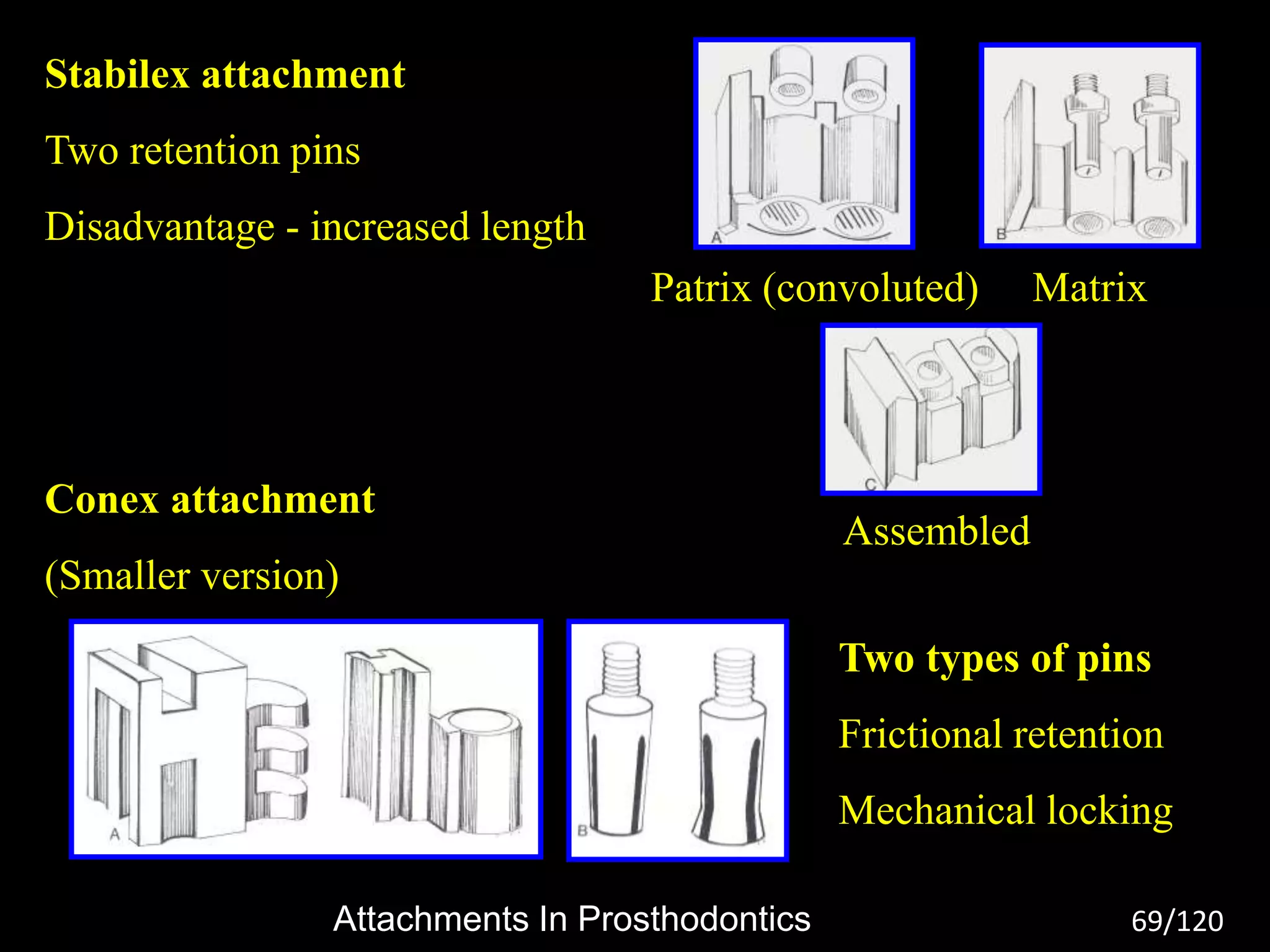 Attachments In Prosthodontics | PPTX