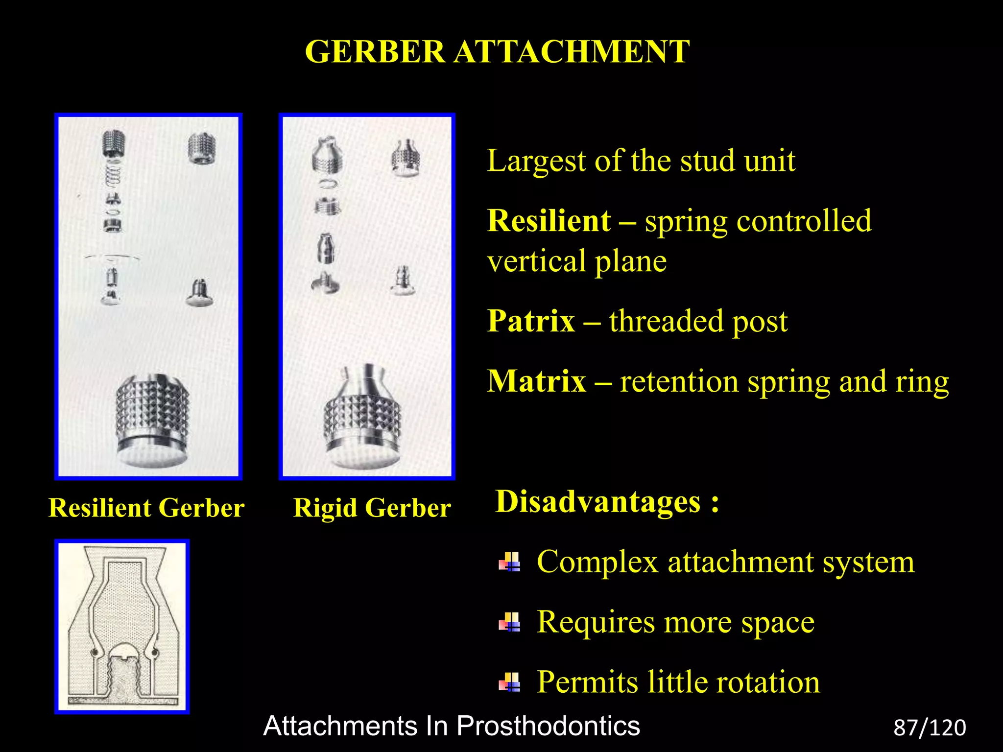 Attachments In Prosthodontics | PPTX