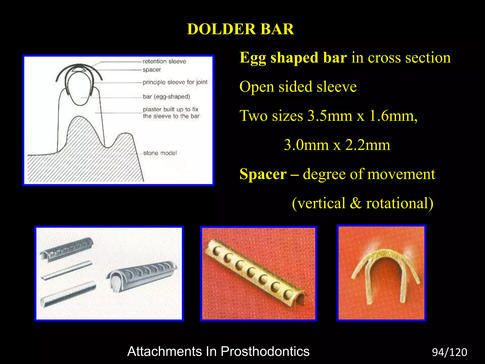 Attachments In Prosthodontics | PPTX