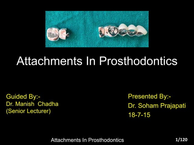 Attachments In Prosthodontics | PPTX