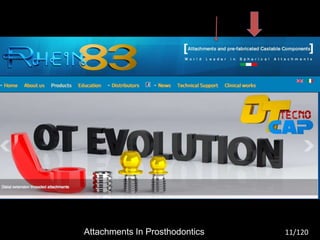 Attachments In Prosthodontics | PPTX