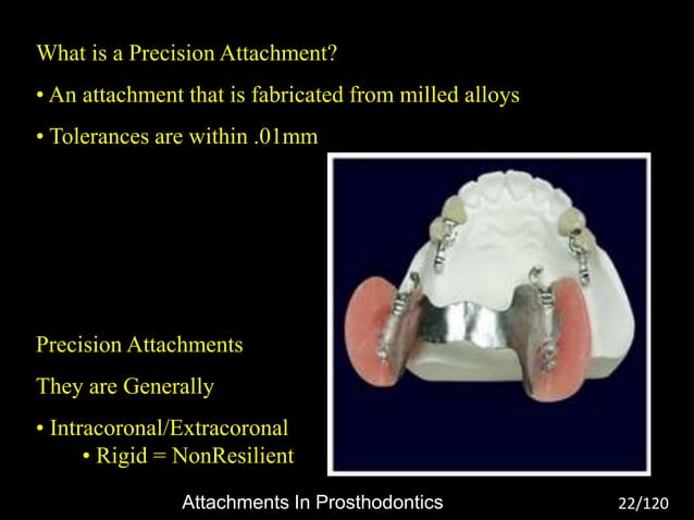 Attachments In Prosthodontics | PPTX