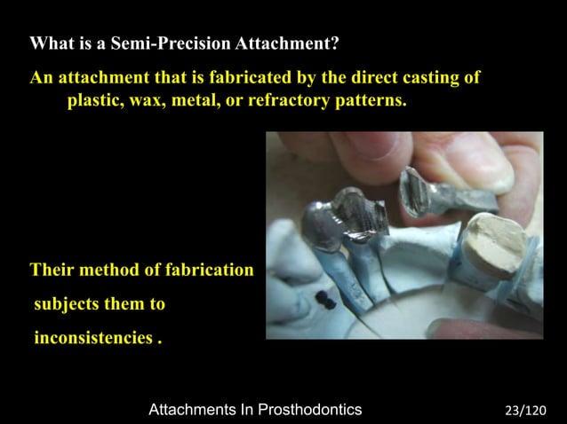 Attachments In Prosthodontics | PPTX