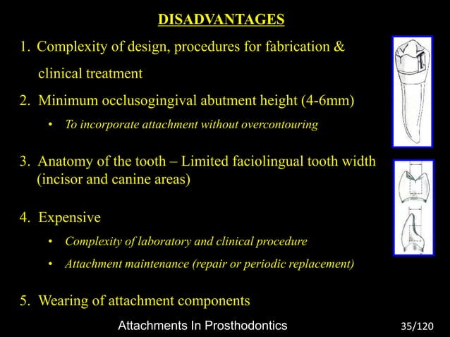 Attachments In Prosthodontics | PPTX