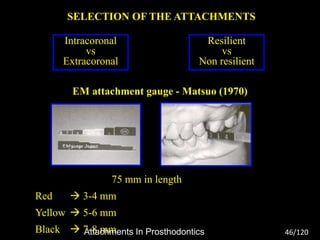 Attachments In Prosthodontics | PPTX