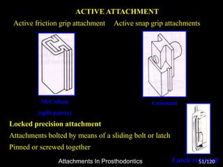 Attachments In Prosthodontics | PPTX