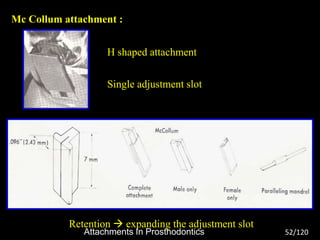 Attachments In Prosthodontics | PPTX