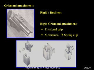 Attachments In Prosthodontics | PPTX