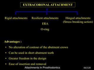 Attachments In Prosthodontics | PPTX