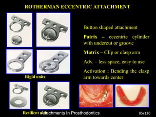 Attachments In Prosthodontics | PPTX