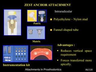 Attachments In Prosthodontics | PPTX