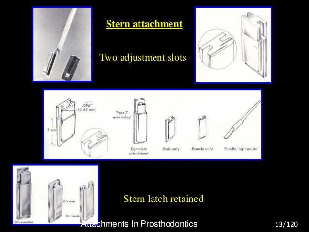 Attachments In Prosthodontics