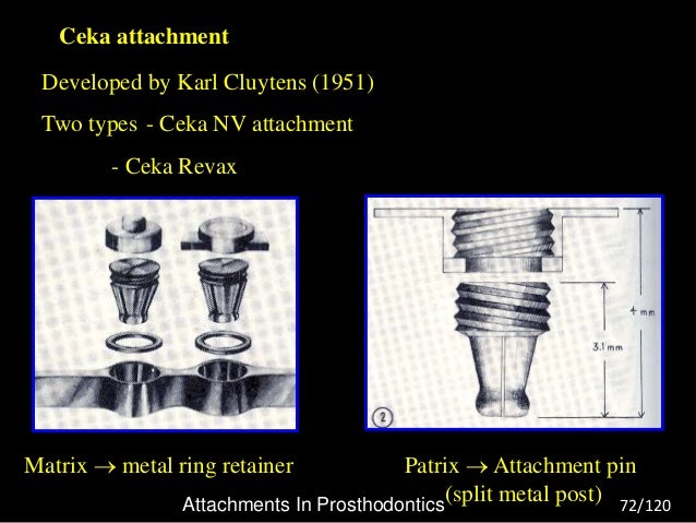 Attachments In Prosthodontics