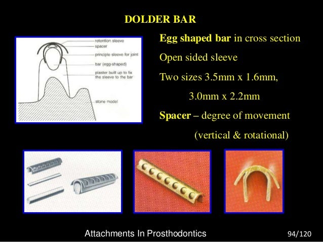 Attachments In Prosthodontics