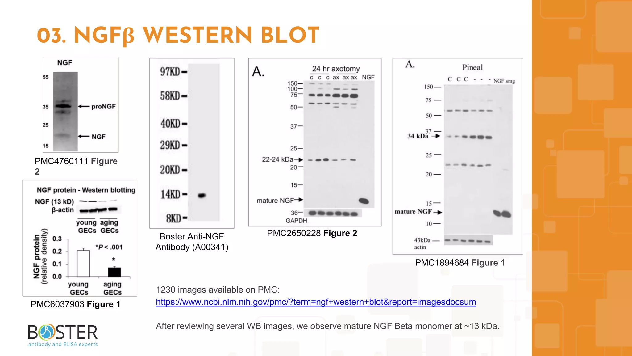 Learn NGF/NGF Beta in 3 minutes | Beta-nerve growth factor | PPTX