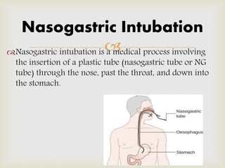 Nasogastric intubation | PPT