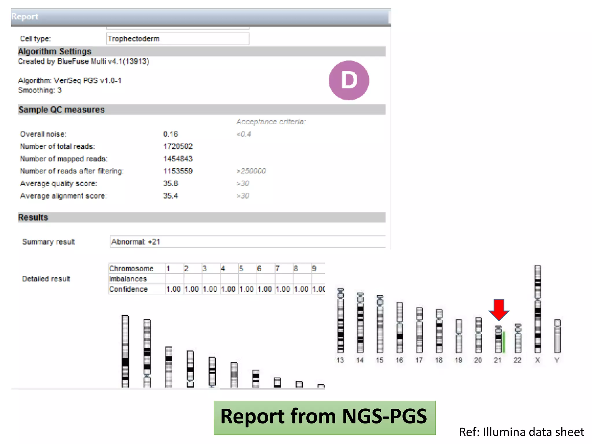 Next generation sequencing in preimplantation genetic screening (NGS in ...
