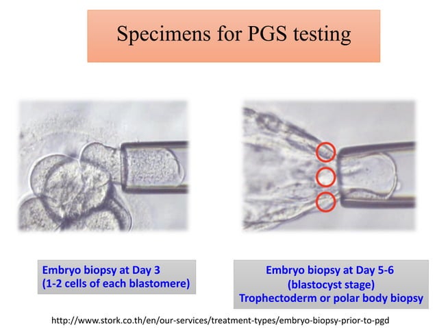 Next generation sequencing in preimplantation genetic screening (NGS in ...