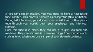 NGT Feeding.pdf