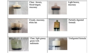 NGT Feeding.pdf