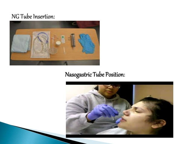 Nasogastric tube (NG tube) | PPTX | Ear, Nose and Throat Conditions ...