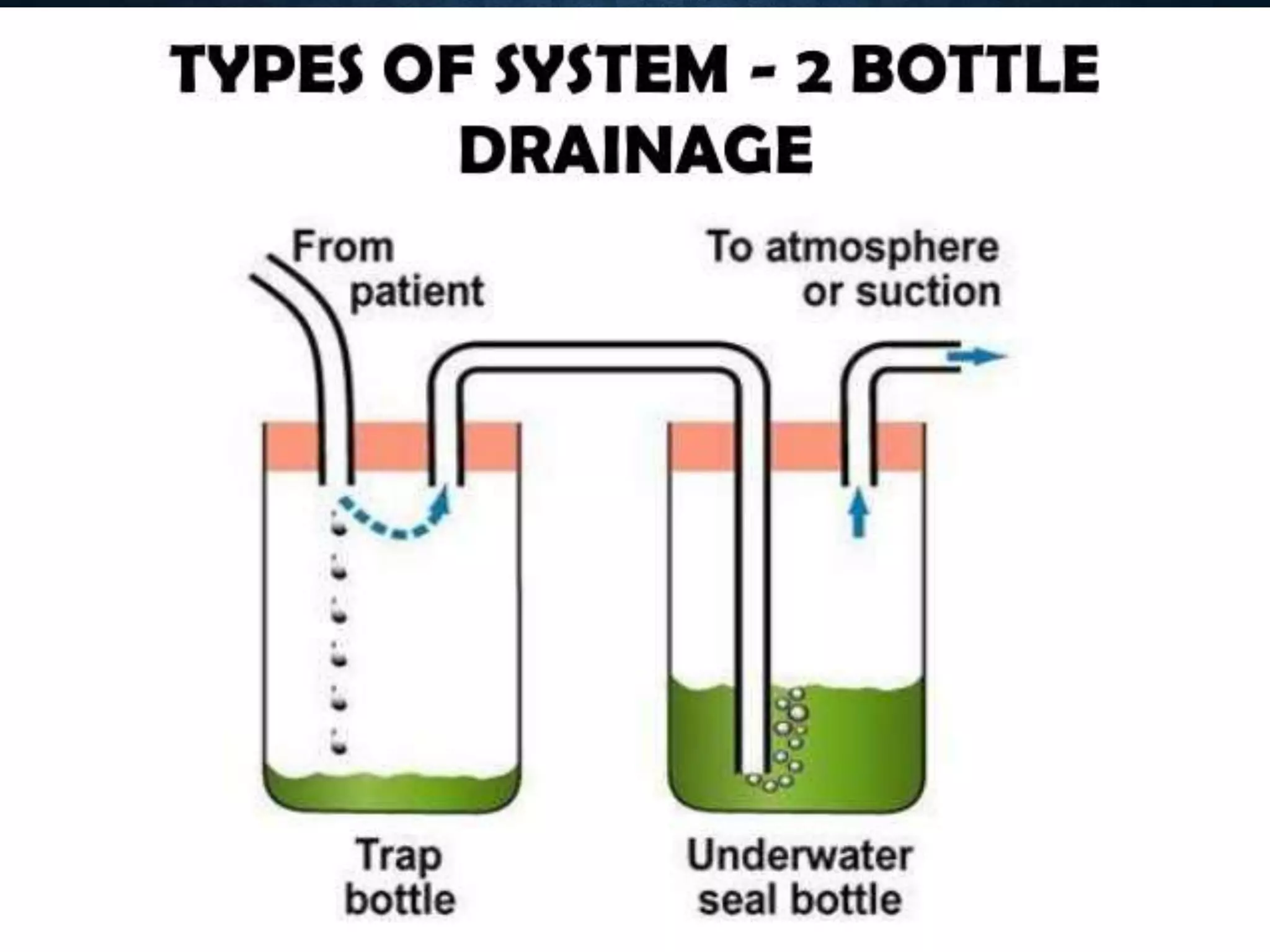 Water Seal Drainage | PPTX