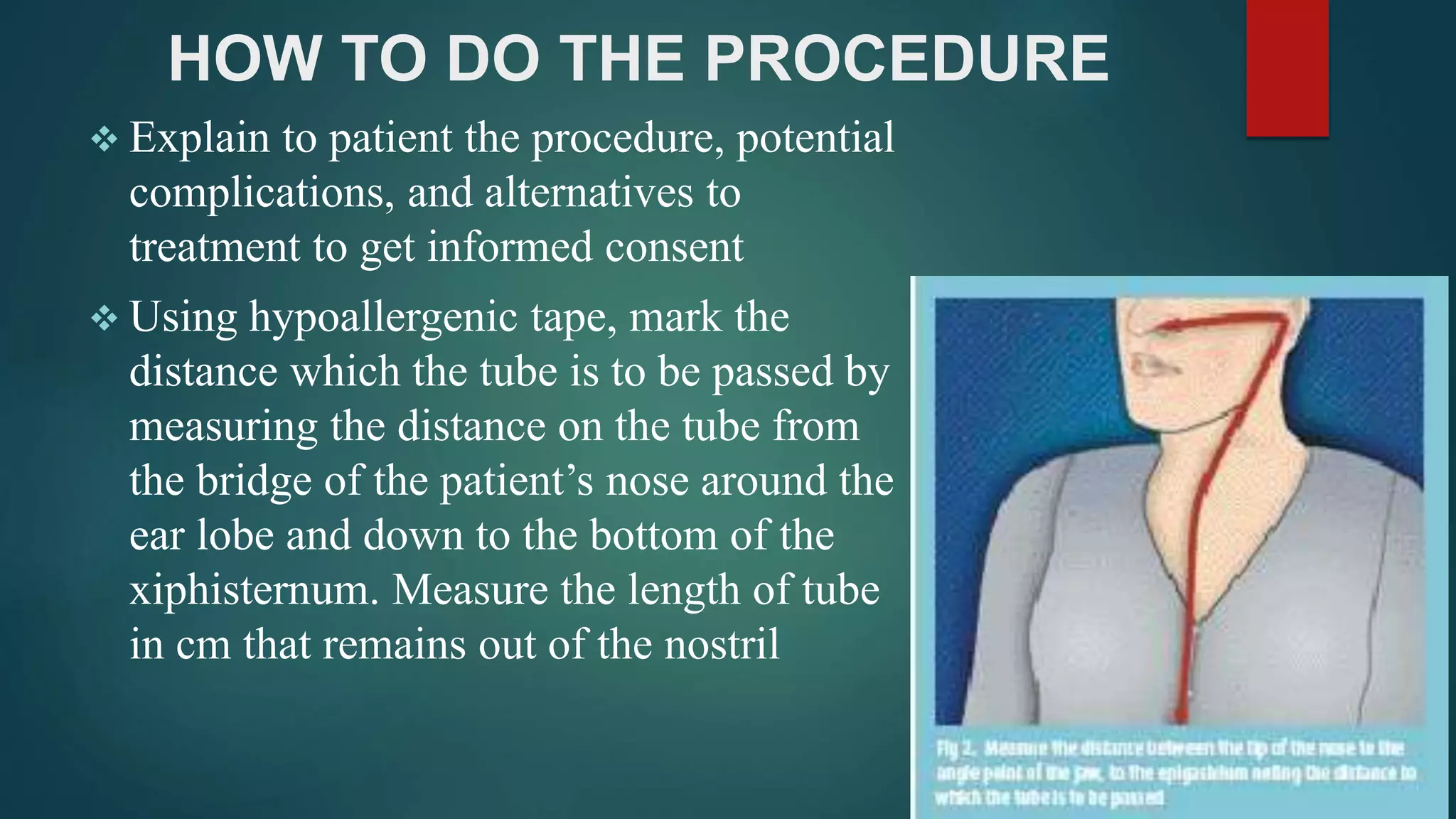 Ng tube | PPTX