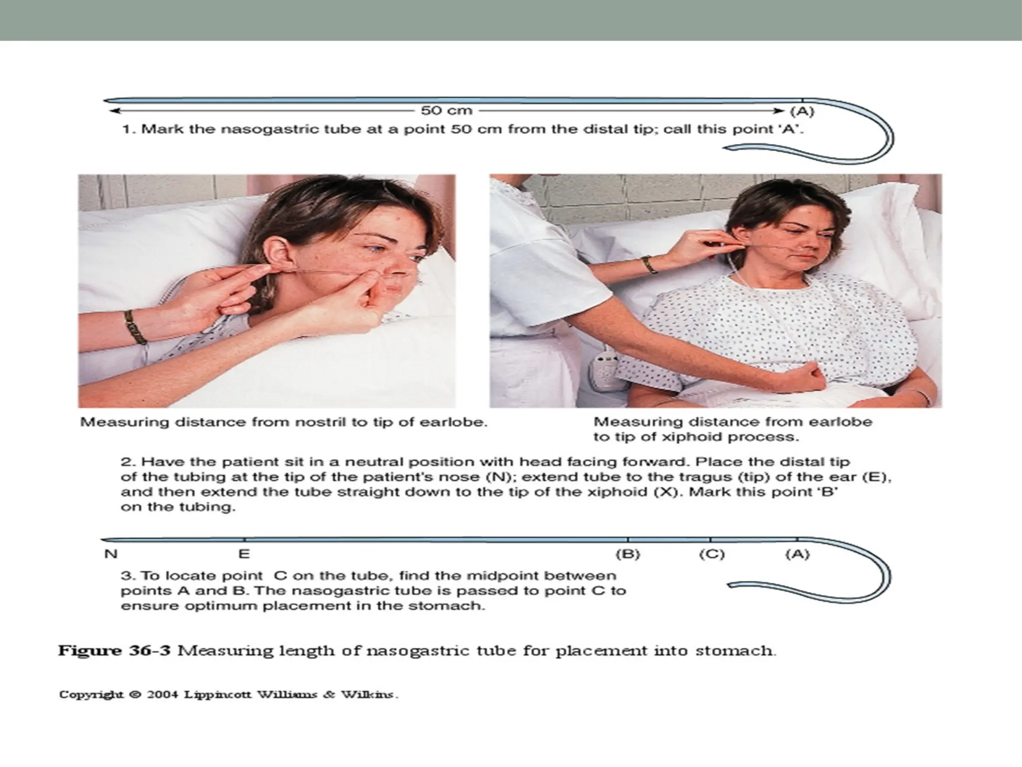 NG tube application and types nursing presetation.pptx