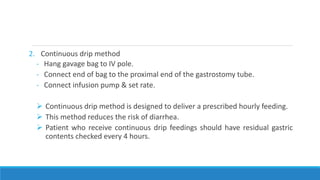 Ng tube feeding | PPTX