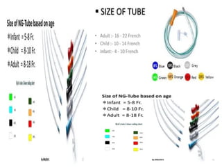 NG Tube Feeding.pptxRYLES TUBE FFEDING PROCEDURE | PPTX