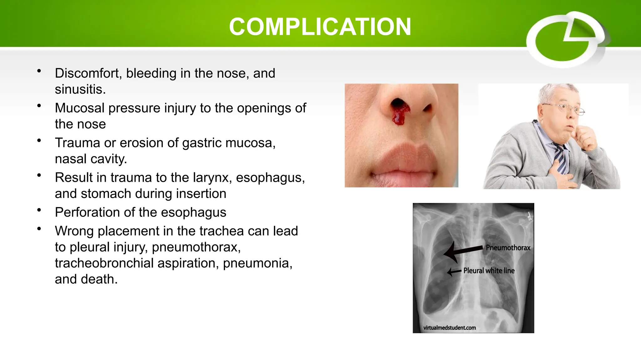 NG TUBE FEEDING.INTRODUCTION,DEFINITION,INDICATION,TYPES ...