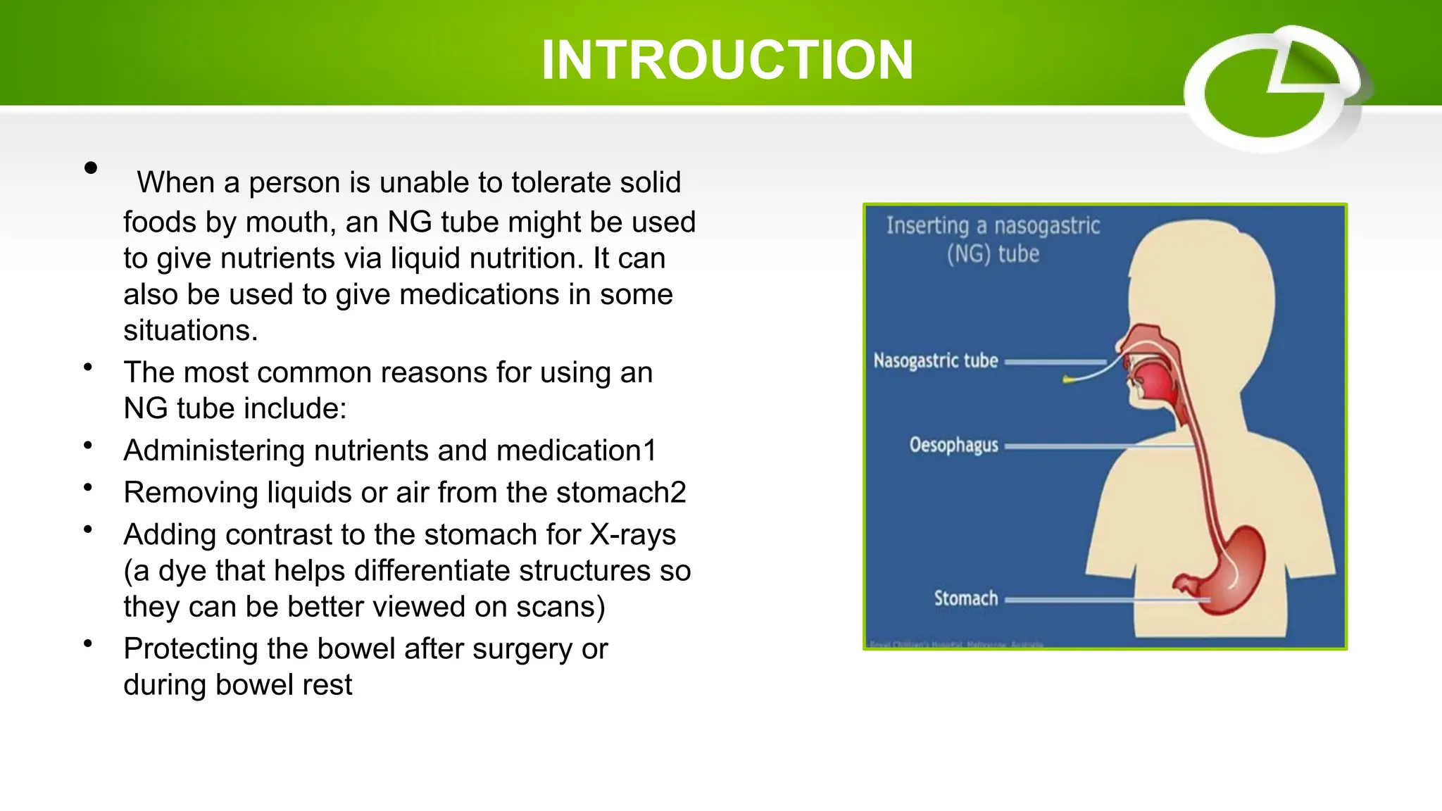 NG TUBE FEEDING.INTRODUCTION,DEFINITION,INDICATION,TYPES ...