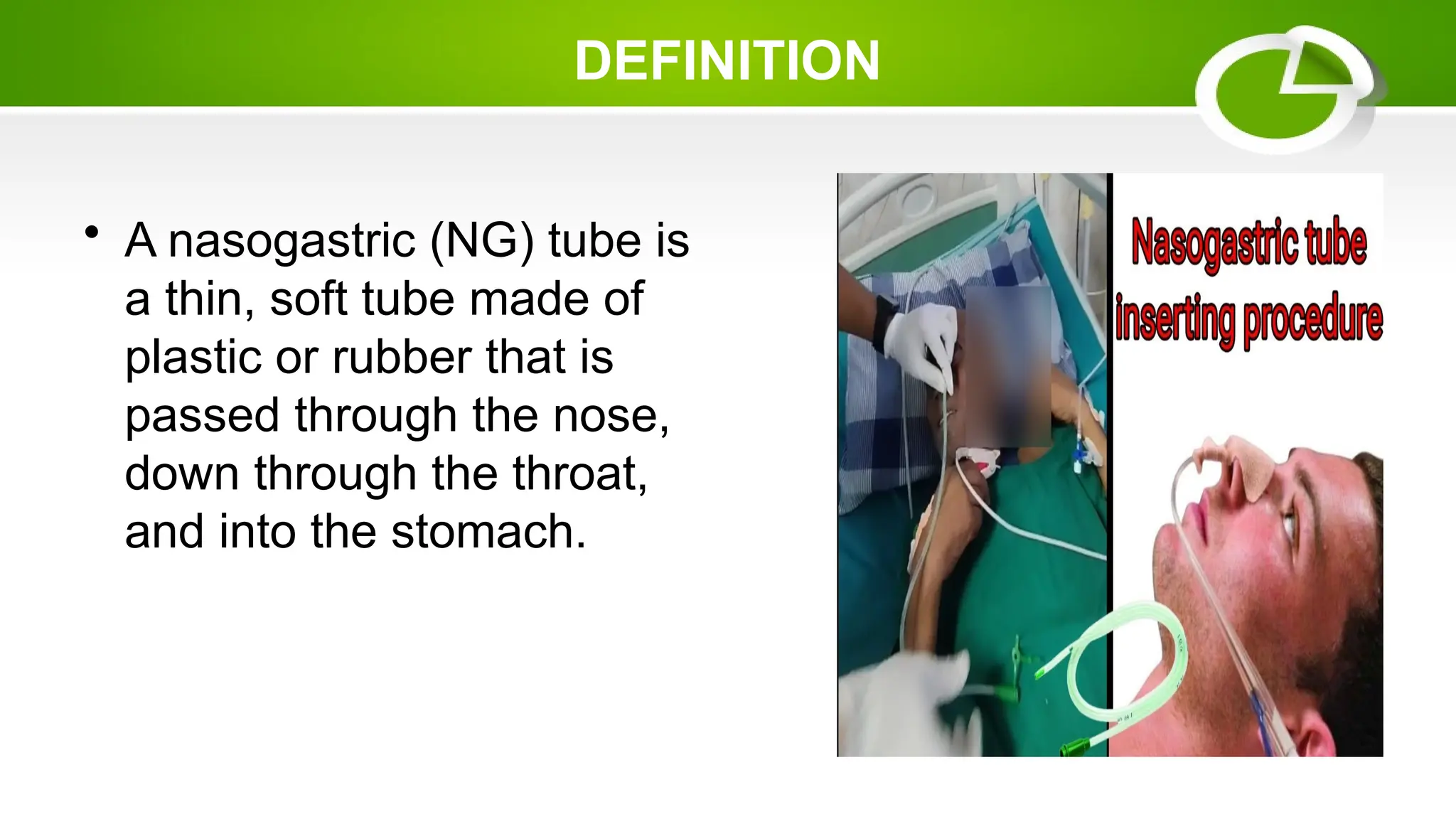 NG TUBE FEEDING.INTRODUCTION,DEFINITION,INDICATION,TYPES ...