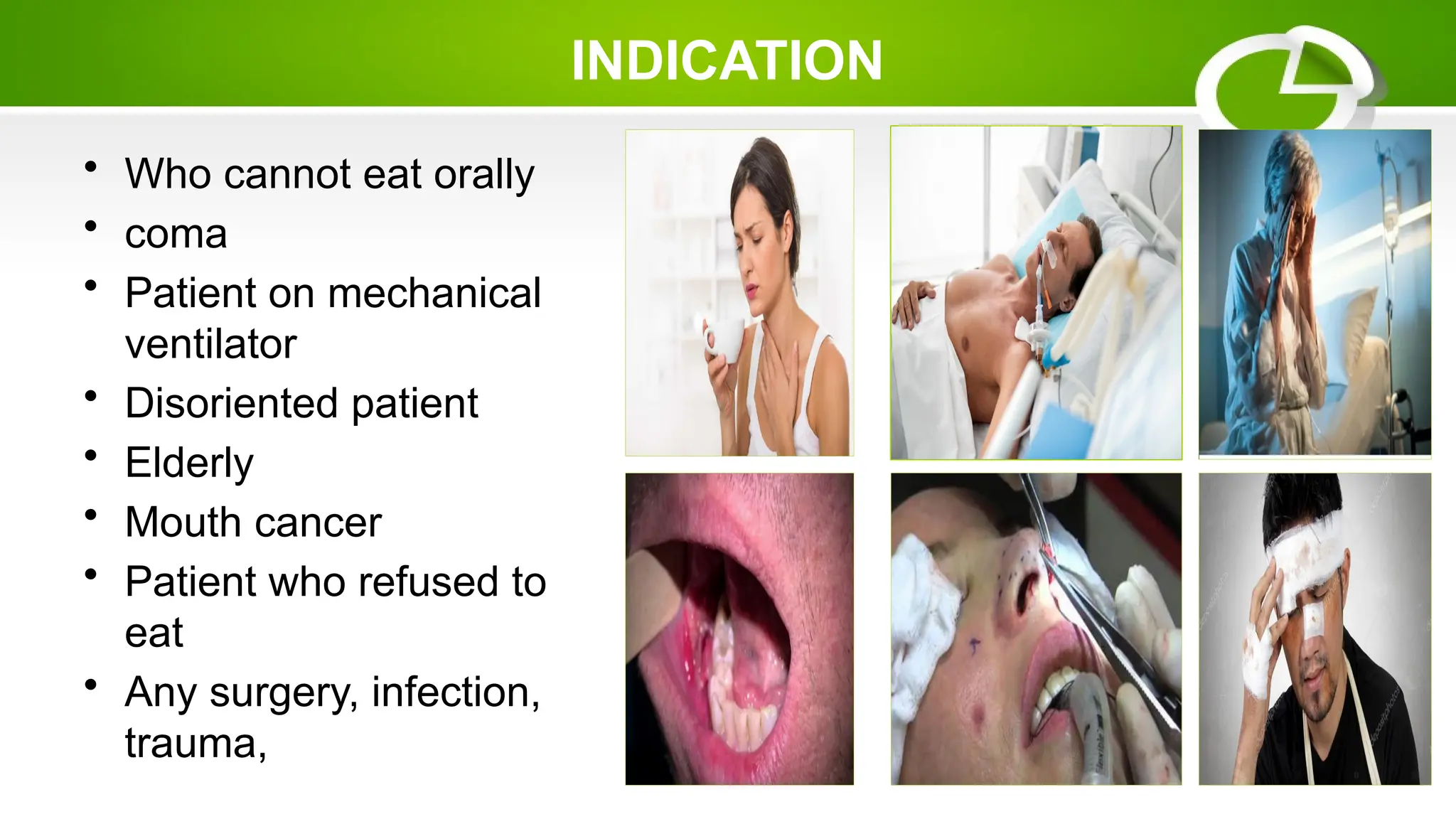 NG TUBE FEEDING.INTRODUCTION,DEFINITION,INDICATION,TYPES ...