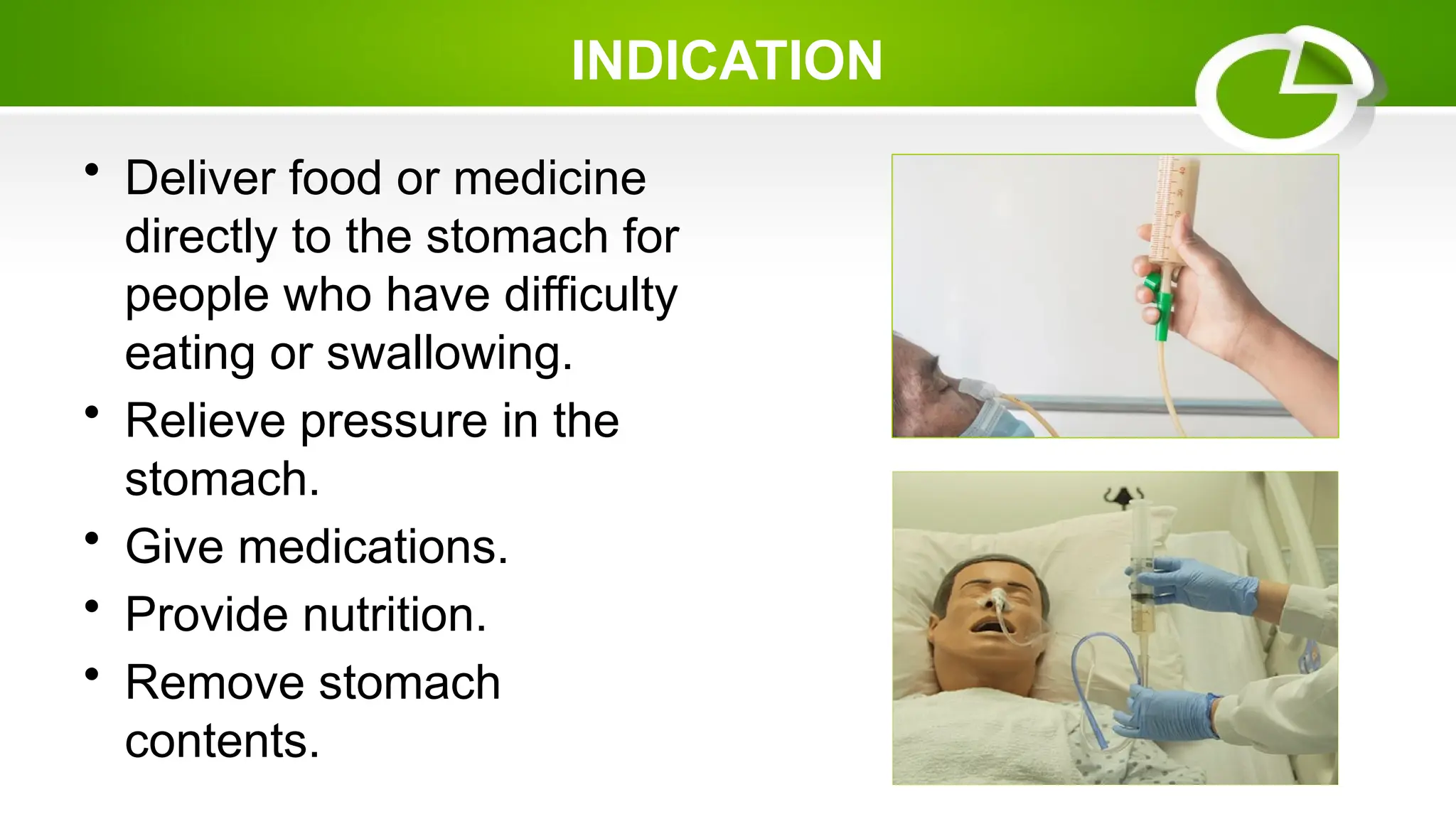 NG TUBE FEEDING.INTRODUCTION,DEFINITION,INDICATION,TYPES ...