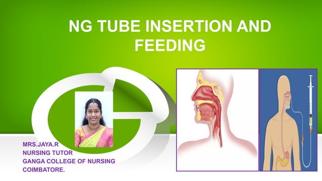 NG TUBE FEEDING.INTRODUCTION,DEFINITION,INDICATION,TYPES ...