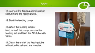 NG TUBE FEEDING.INTRODUCTION,DEFINITION,INDICATION,TYPES ...