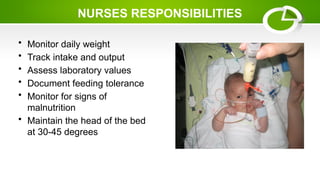 NG TUBE FEEDING.INTRODUCTION,DEFINITION,INDICATION,TYPES ...