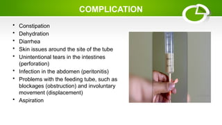 NG TUBE FEEDING.INTRODUCTION,DEFINITION,INDICATION,TYPES ...