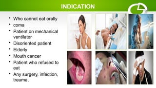 NG TUBE FEEDING.INTRODUCTION,DEFINITION,INDICATION,TYPES ...