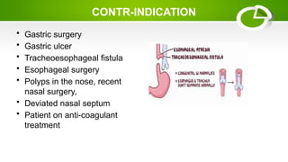 NG TUBE FEEDING.INTRODUCTION,DEFINITION,INDICATION,TYPES ...