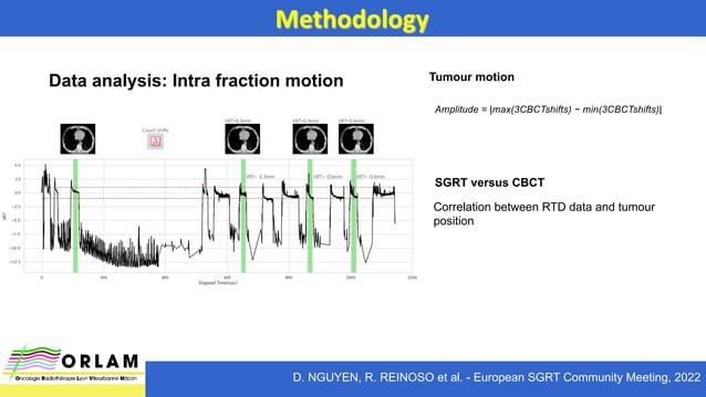 Feasibility Study of Deep Inspiration Breath-Hold Technique with ...