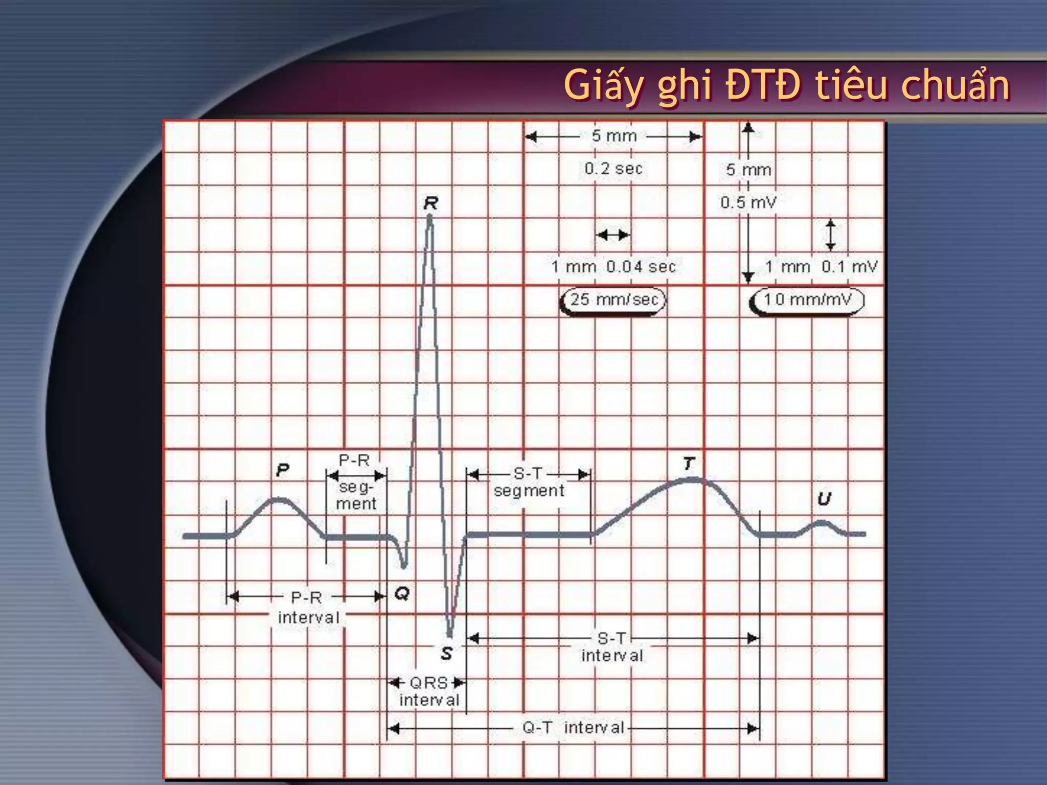 Nguyen ly do dien tim | PPTX