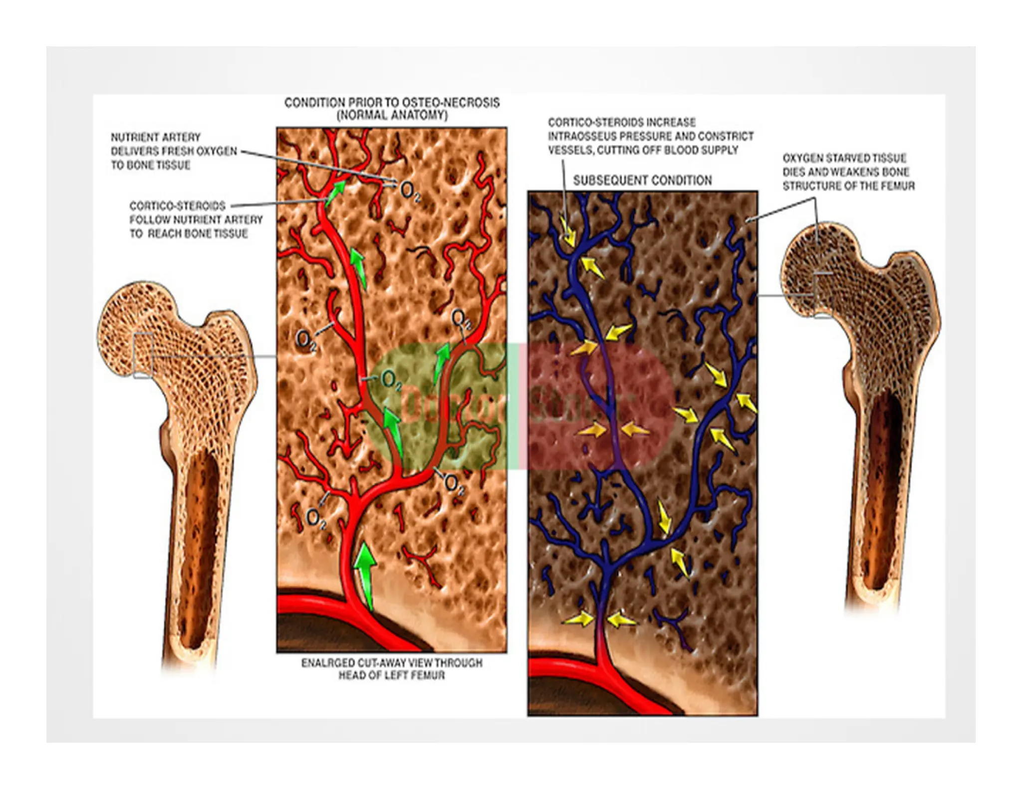 NGUYÊN TẮC SỬ DỤNG CORTICOID.pdf