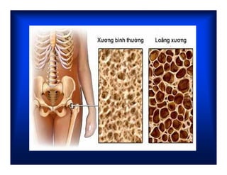 NGUYÊN TẮC SỬ DỤNG CORTICOID.pdf