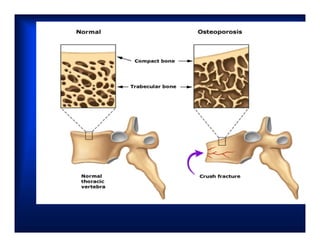 NGUYÊN TẮC SỬ DỤNG CORTICOID.pdf