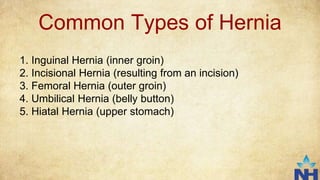 All you need to know about Hernia | PPTX